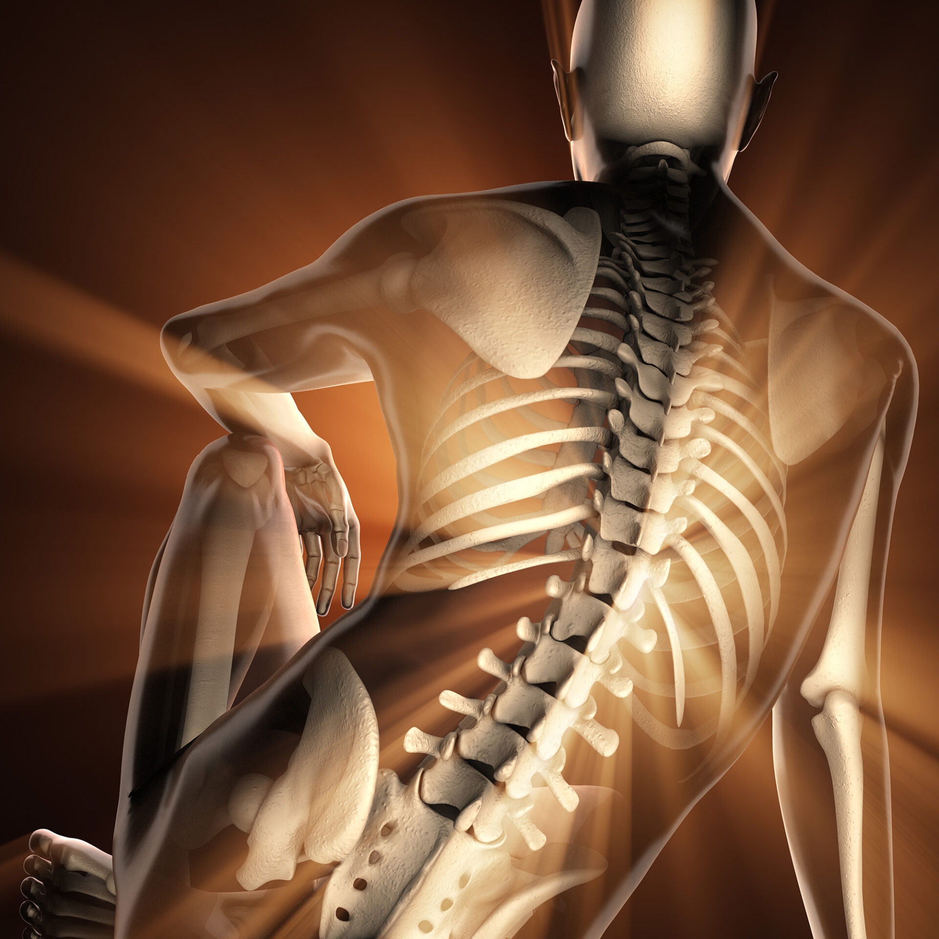 How to Spot Sciatica | IMPACT Magazine